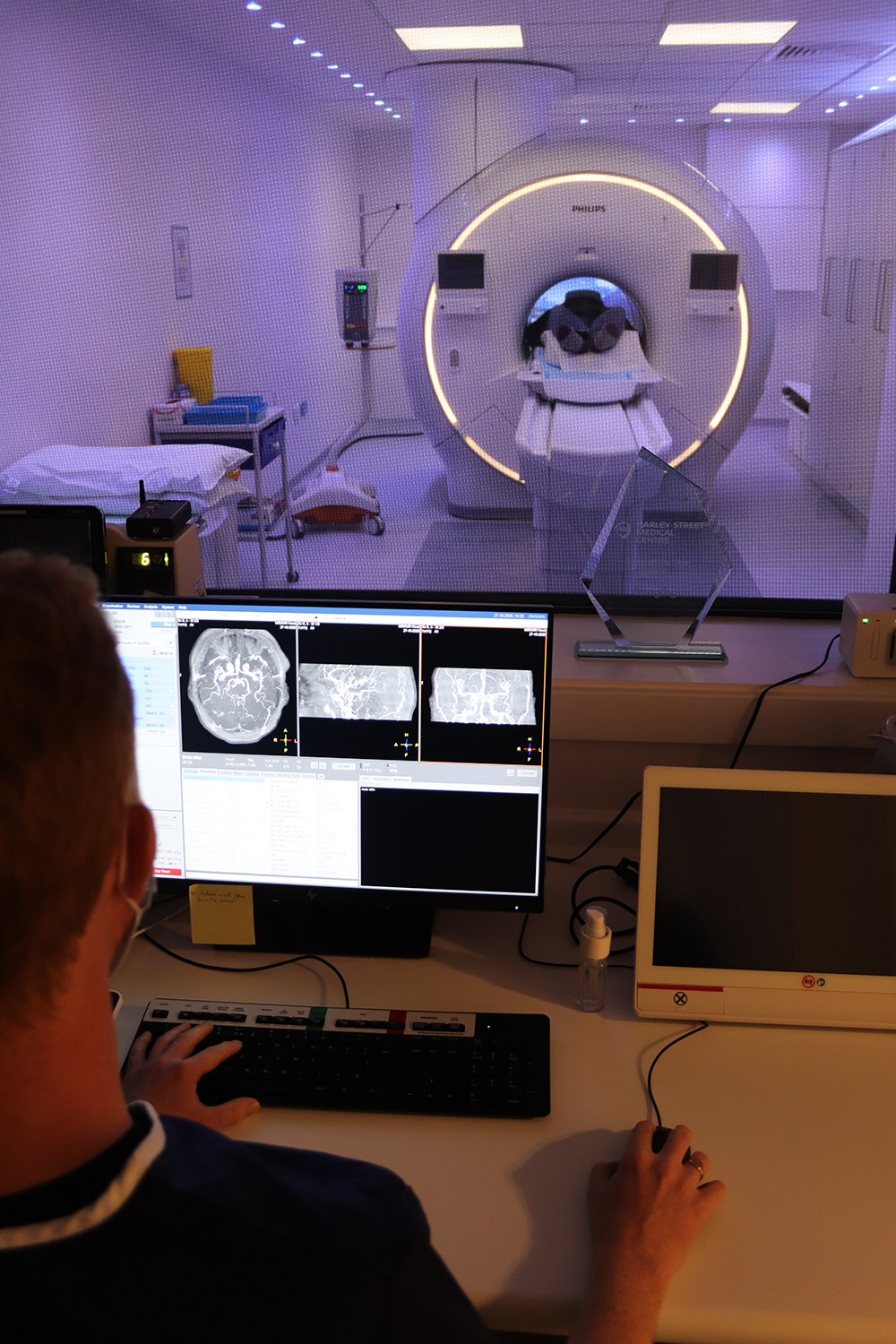 Cardiac MRI Scan - Lumen Harley Street Advanced Health Assessments